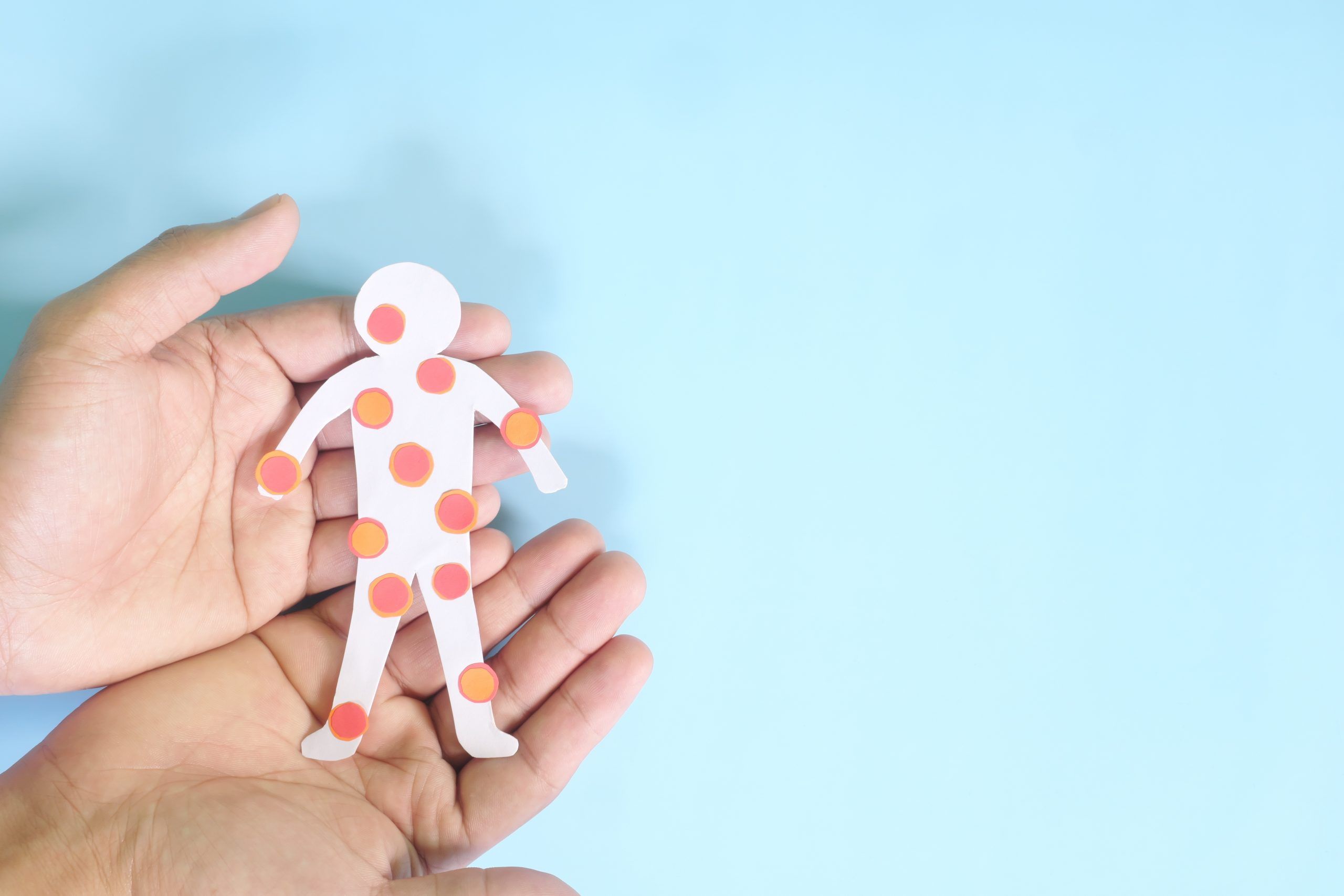 Neurodermitis (Atopische Dermatitis) - Studienteilnehmergesucht.at